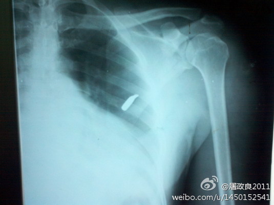 MJ Covers One of the 'Top Uncovered but Important Stories of Our Time ...